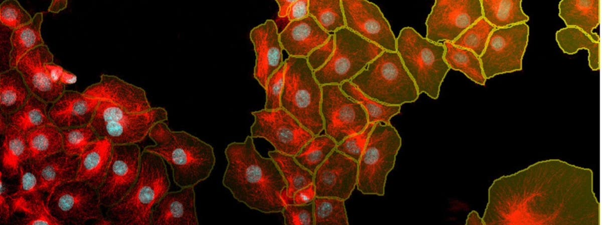 Vereinfachung der Instanzsegmentierung von Zellen und Zellkernen durch Deep Learning | Olympus LS