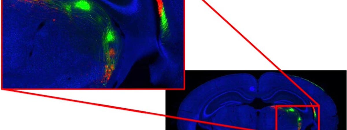 Austausch von Bildern leicht gemacht – mit OlyVIA | Olympus LS