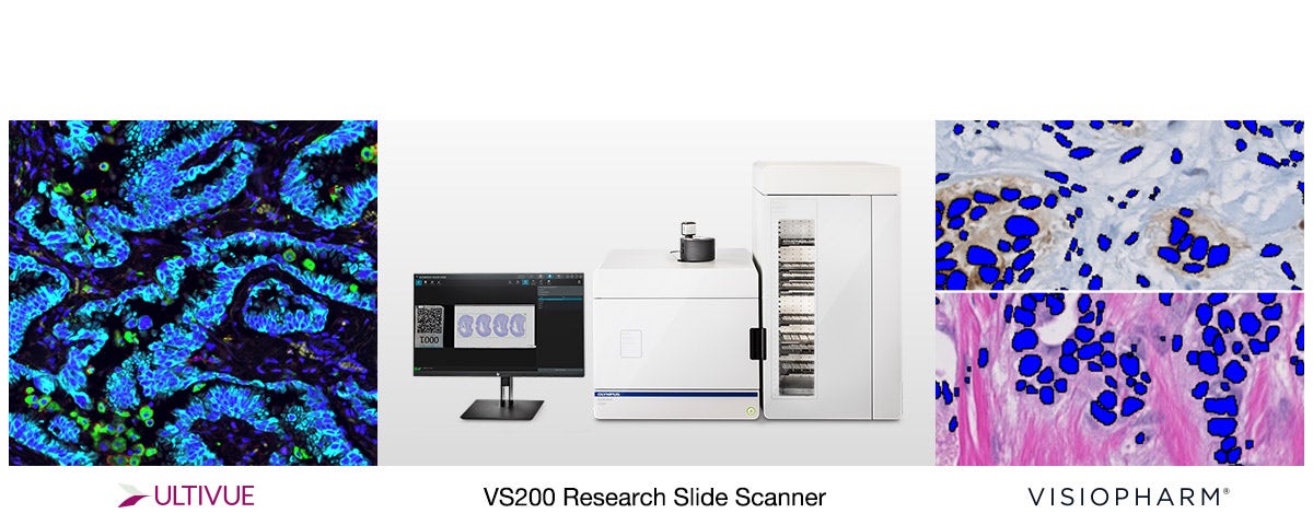 Biomarker Cell Phenotyping Solutions | Olympus LS