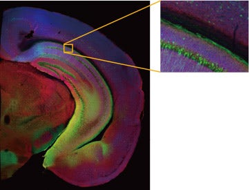 Mapping Aortic Valve Cells Using the FLUOVIEW FV3000 Microscope ...
