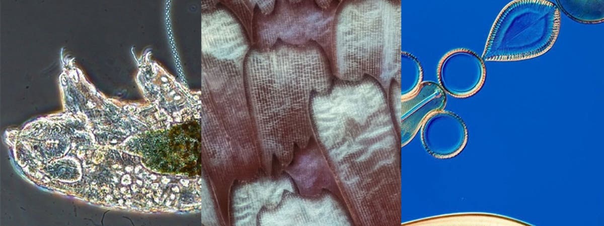 Bugs, Butterflies, and Birds—Our Most Popular Microscope Images for ...