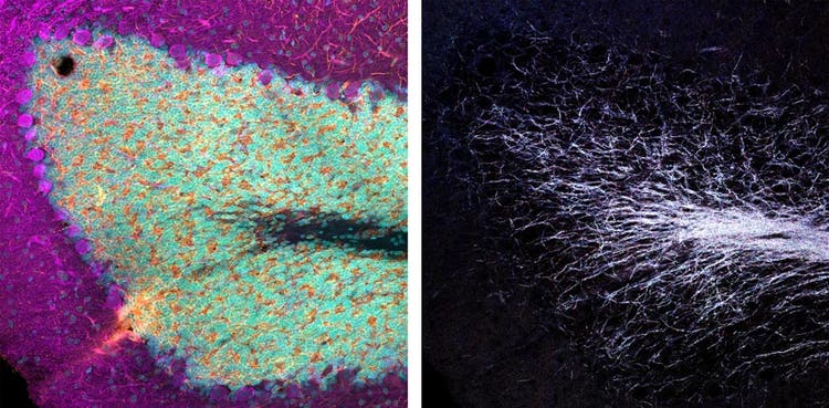 A Smart Strategy for Reflectance Confocal Imaging | Olympus LS