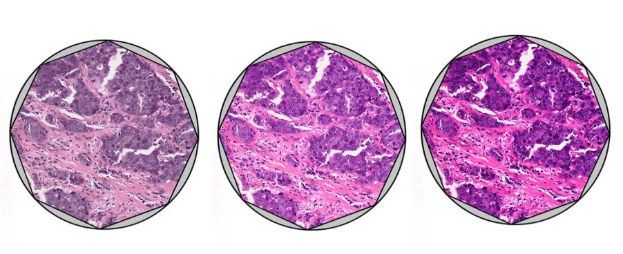 How to Align Köhler Illumination in 6 Simple Steps | Olympus LS