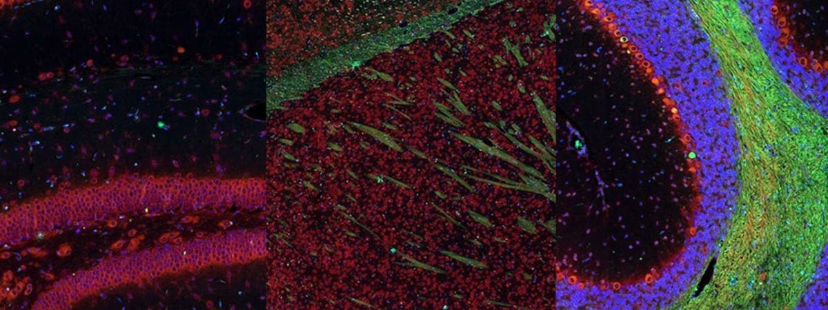 Bugs and Brains: Our Most Popular Microscope Images for May 2021 ...