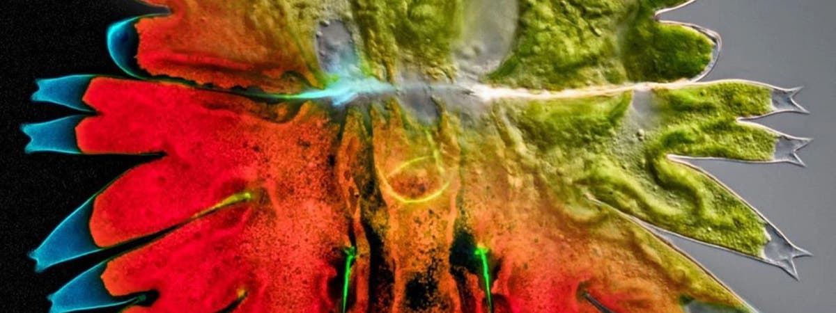 Takeover Recap: Our Most Popular Microscope Images for February 2020 ...