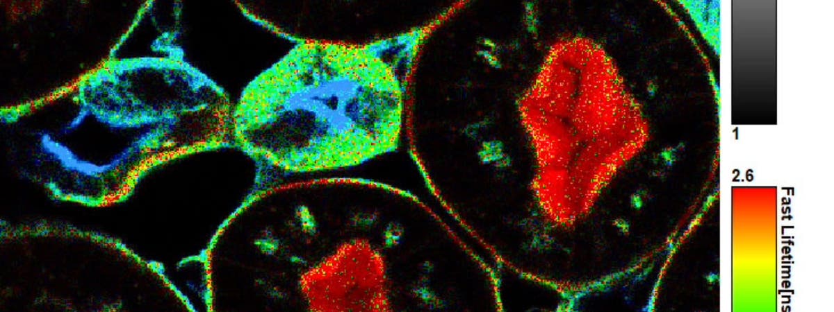 Good Optics—Improving Single-Molecule Sensitivity in Confocal ...