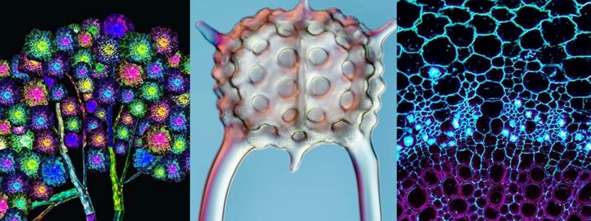 Protists, Plants, and Tigers: Our Most Popular Microscope Images for ...