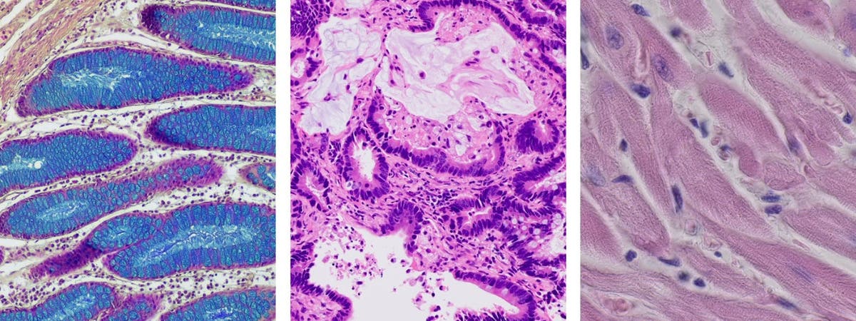 What Is Brightfield Microscopy? | Olympus LS