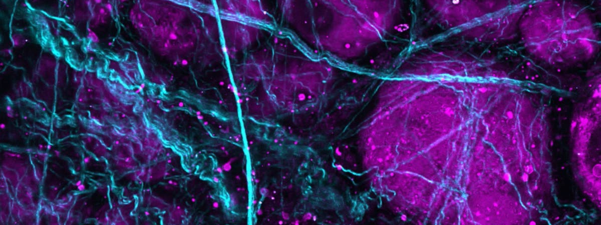 Thinking Beyond Fluorescence: Biological Imaging with SHG and THG ...