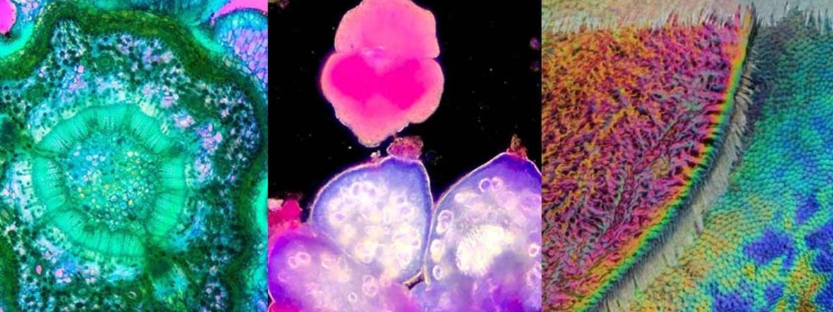 Breadth of Beauty—Our Most Popular Microscope Images for August 2023 ...