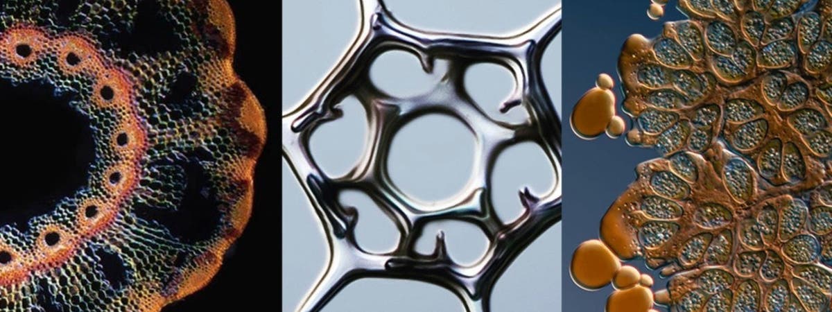 From A to Z: Our Most Popular Microscope Images for February 2021 ...