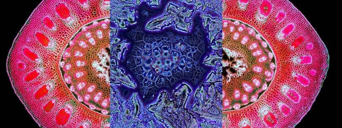 Magnificent Microorganisms—Our Most Popular Microscope Images for ...