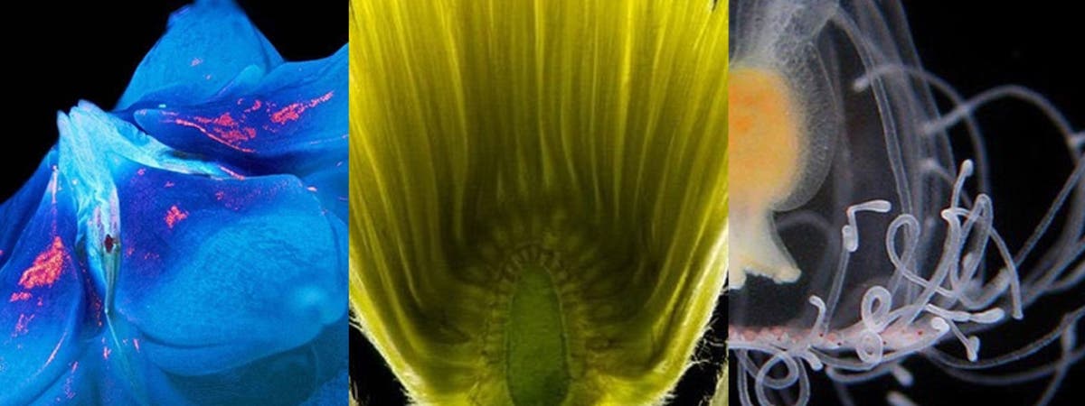 Oceans, Organs, and the Outdoors: Our Most Popular Microscope Images ...