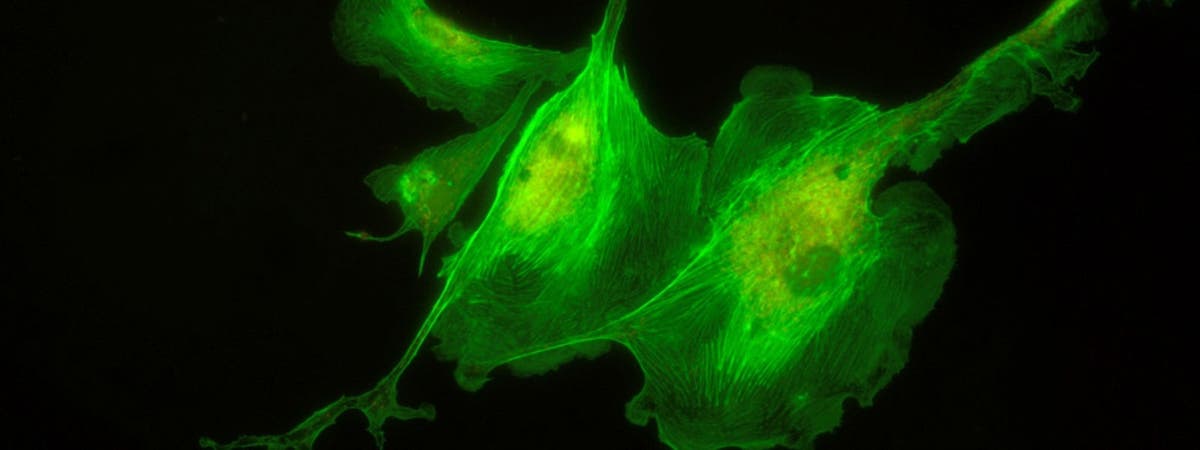 Meet the Award-Winning DP28 and DP23 Microscope Cameras | Olympus LS