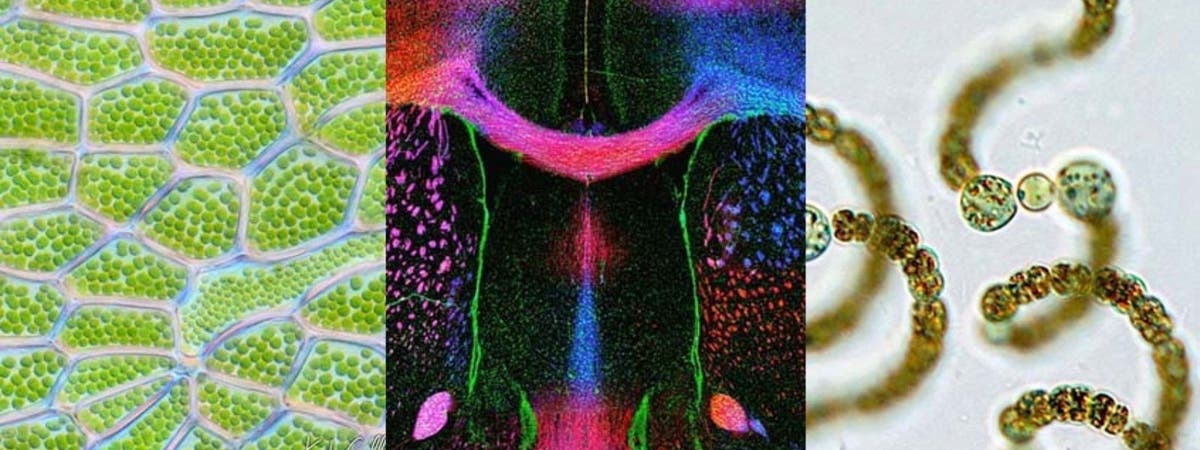 Brains, Bugs, and Bacteria: Our Most Popular Microscope Images for ...