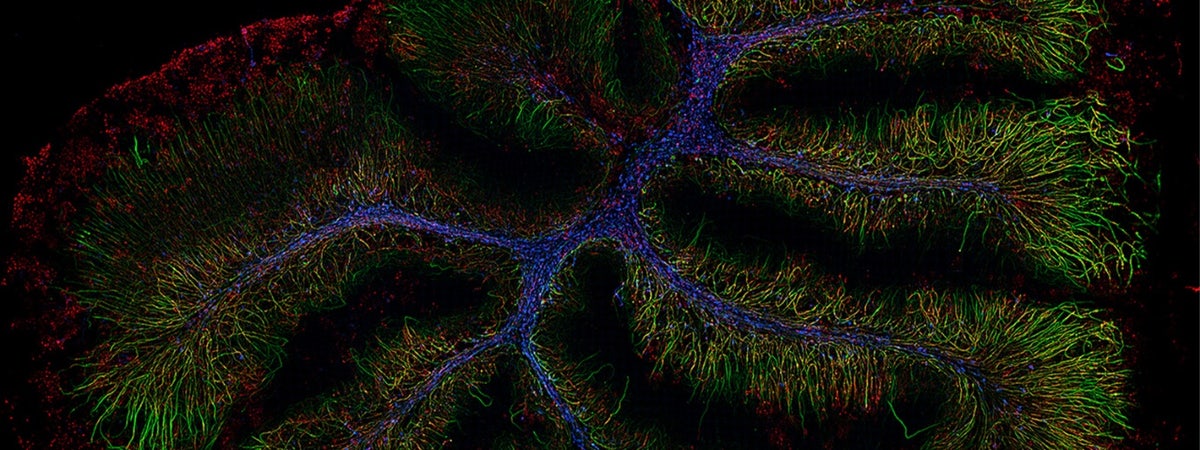 How to Remove Image Blur in Thick Samples without Going Confocal ...