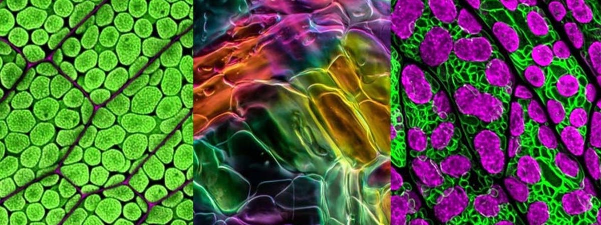 Easy Being Green—Our Most Popular Microscope Images for June 2023 ...