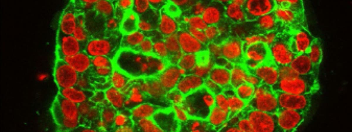 3 Ways Microscope Imaging Advances Organoid Research