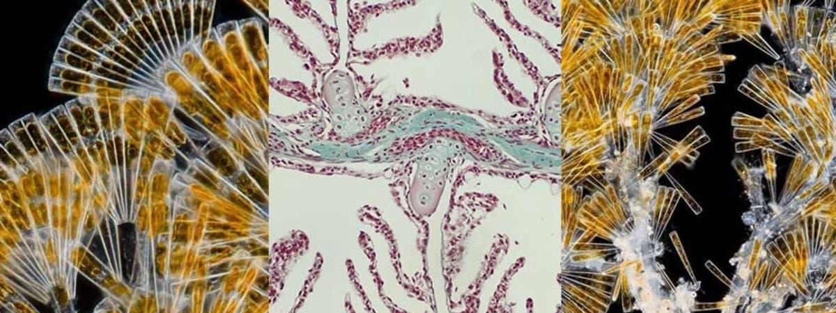 Colors of Spring—Our Most Popular Microscope Images for March 2023 ...