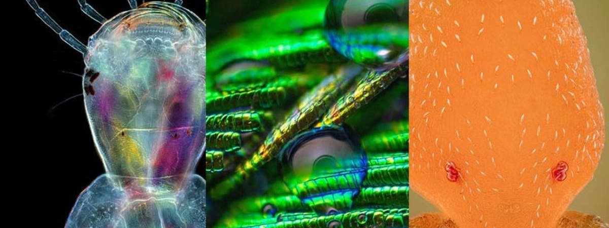 An Eye for Detail—Our Most Popular Microscope Images for November 2021 ...