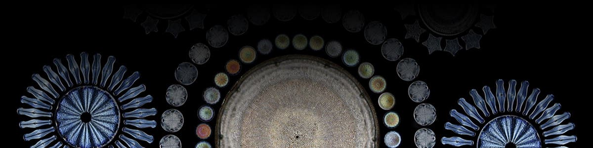 BioScapes Structured Illumination Technique | Olympus LS