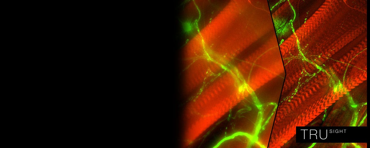 TruSight Technology | Evident