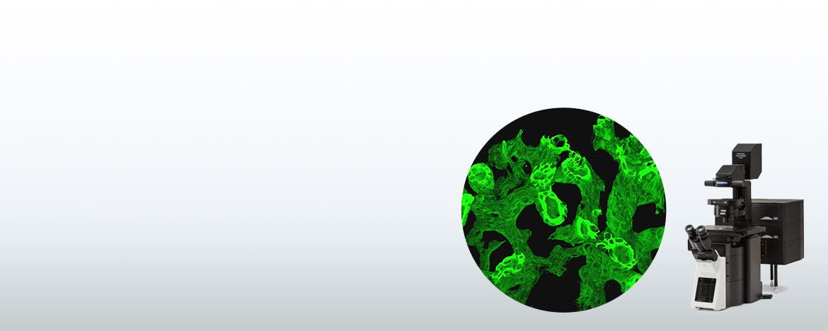 Confocal Laser Scanning Imaging | Olympus LS