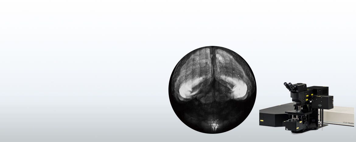 Multiphoton and Deep Imaging | Olympus LS