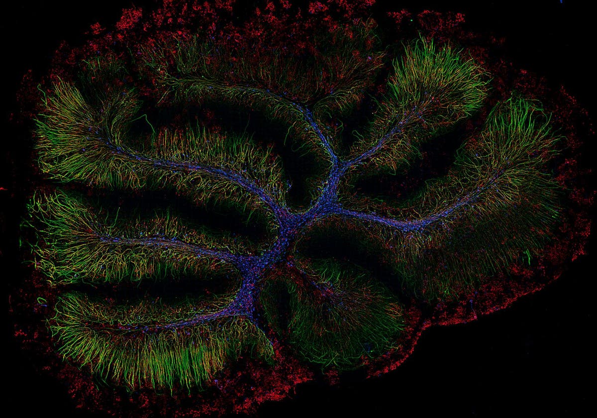 SILA Optical Sectioning Method for Sharp Imaging of Thick Samples ...