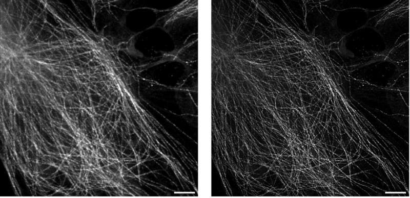 How the TruSight™ SR Algorithm Achieves Super-Resolution Imaging in ...