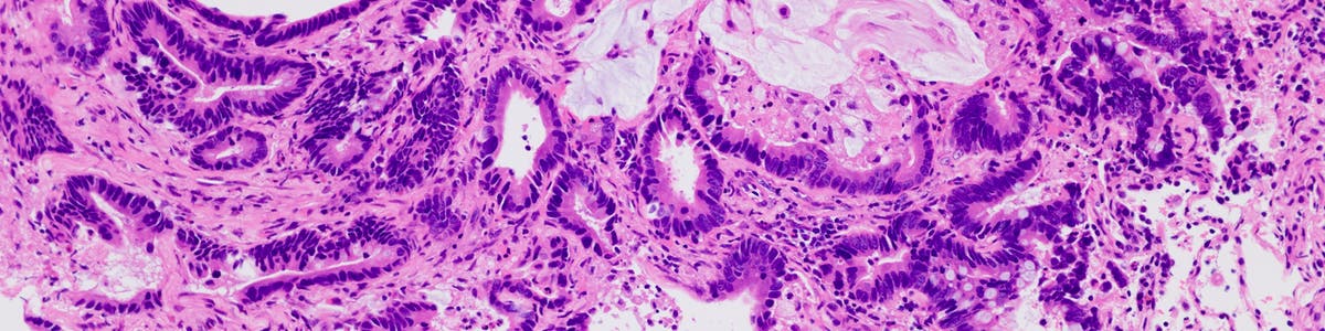 Clinical Microscopes | Olympus