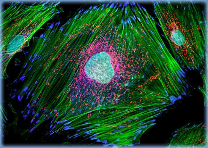Labeling A-10 Cells for Focal Adhesions with Immunofluorescence