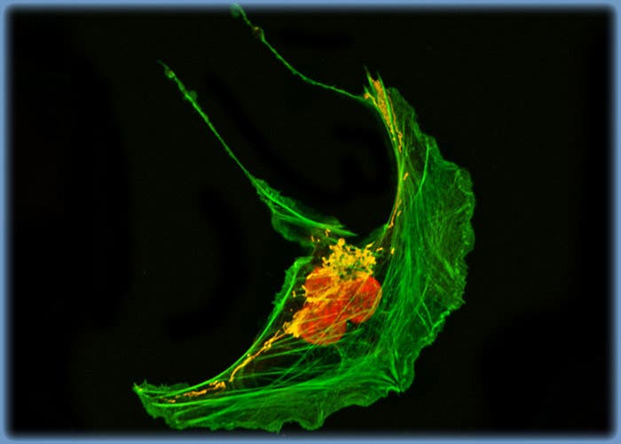 U-2 OS Cells Triple Labeled with BODIPY FL, MitoTracker Red CMXRos, and ...
