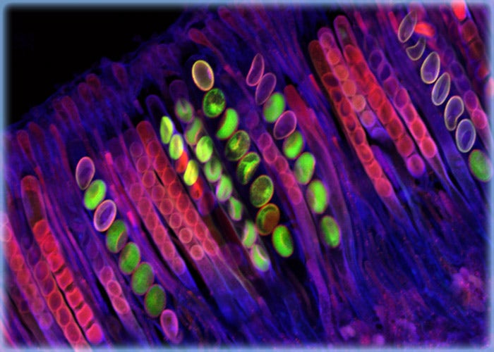 Cup Fungus Microscope Image | Plant Cell Microscopy