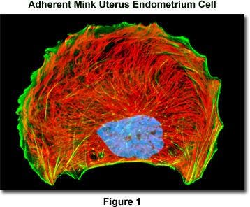 Confocal Microscopy - Intermediate Filament Stains | Evident Scientific