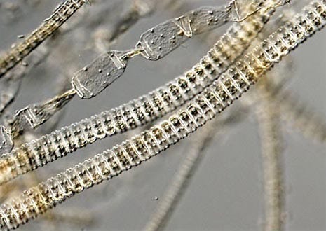 Zygnema Filamentous Algae | Evident Scientific