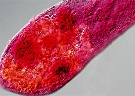 Intestinal Fluke (Heterophyes) | Evident Scientific
