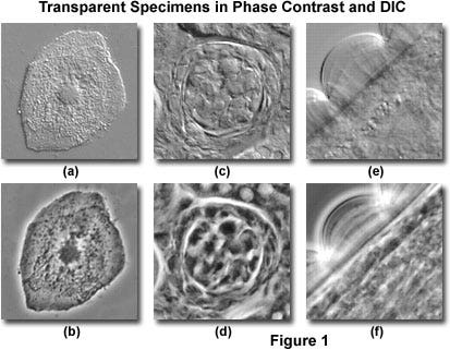 Comparison of Phase Contrast and DIC Microscopy