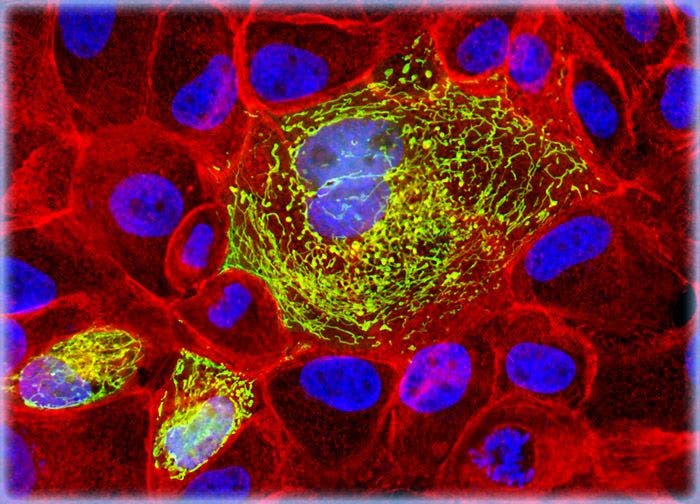 Madin-Darby Canine Kidney Epithelial Cells (MDCK Line)