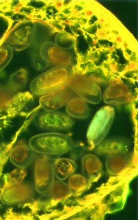 Leeches | Evident | Fluorescence Microscopy Image