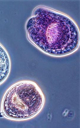 Hydatid Disease Phase Contrast Microscopy Image | Gallery