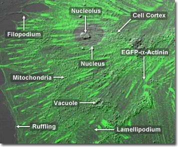 Rat Thoracic Aorta Cells with EGFP Actinin