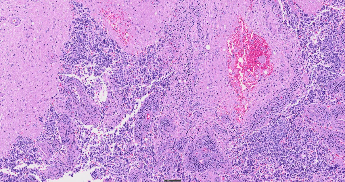 EVIDENT Introduces the SLIDEVIEW™ DX VS200 Whole Slide Scanner, a CE ...