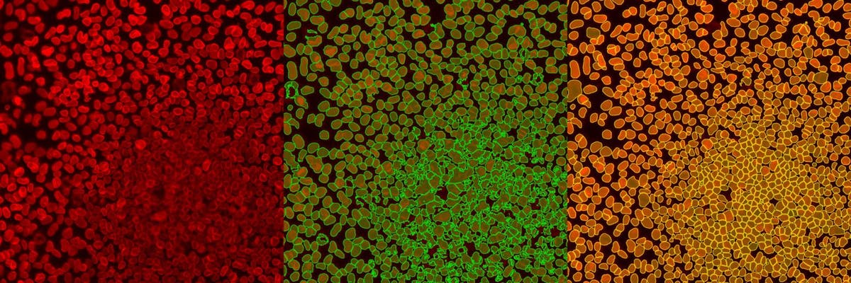 Olympus scanR High-Content Screening Station v. 3.3 Adds Improved Deep ...