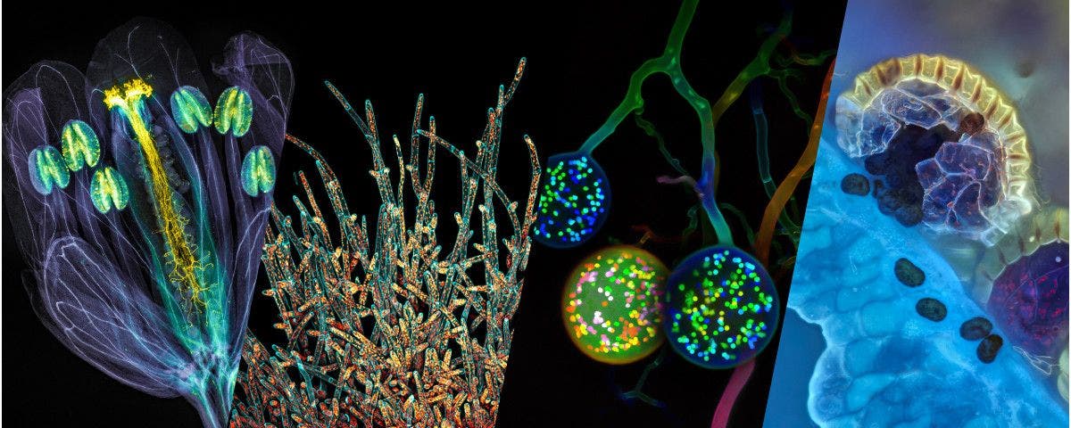 The Art of Science: EVIDENT Launches Expanded Global Image of the Year ...