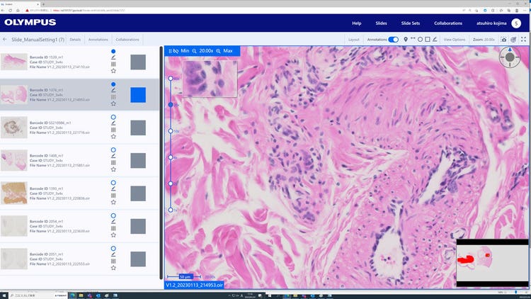 Digital Pathology Slide Scanner | Olympus LS