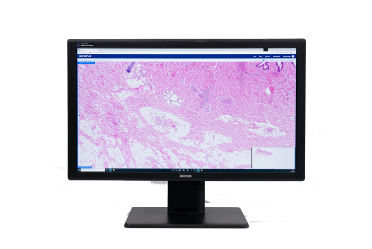 Digital Pathology Slide Scanner | Olympus LS