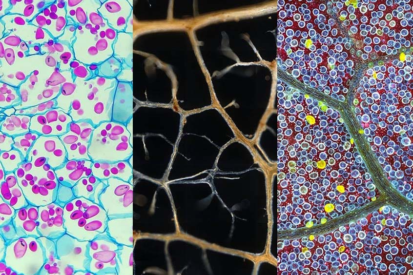 De plancton a plantas: Las imágenes microscópicas más populares del mes ...