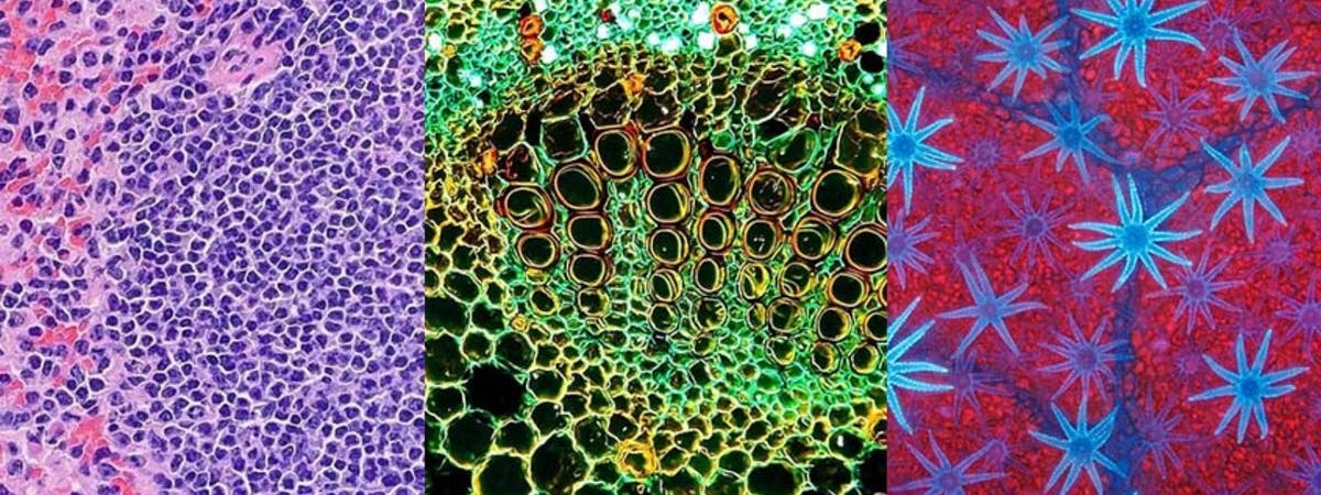 Observación de formas: Las imágenes microscópicas más populares de mayo ...