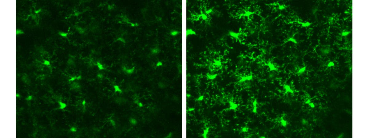 Microscopía multifotón de Olympus | Olympus LS